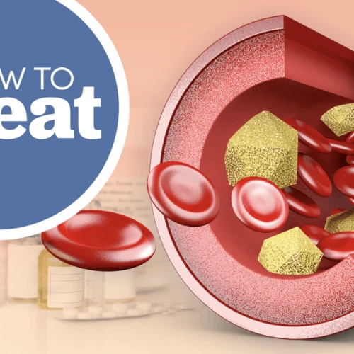 Tratamiento del colesterol alto | ArmolipidPLUS.