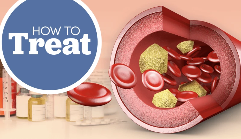 Tratamiento del colesterol alto | ArmolipidPLUS.